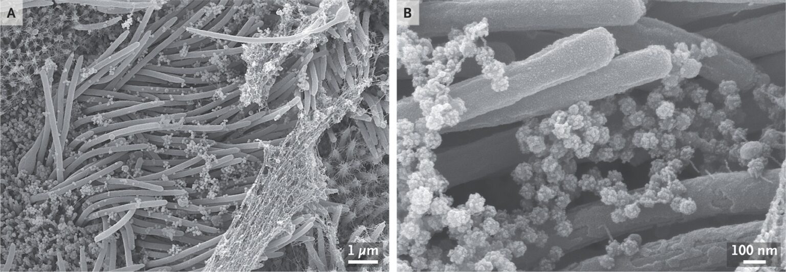 Investigadores publican impresionantes imágenes de cómo el coronavirus ...